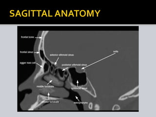 Cross Sectional Anatomy of Paranasal sinus | PPTX
