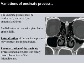 Cross Sectional Anatomy of Paranasal sinus | PPTX