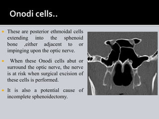 Cross Sectional Anatomy of Paranasal sinus | PPTX