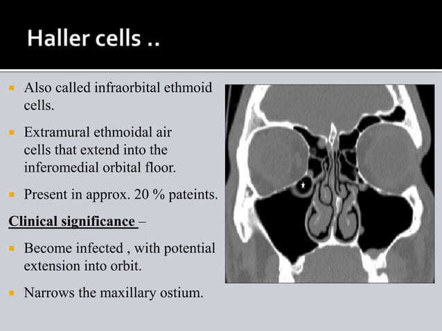 Cross Sectional Anatomy of Paranasal sinus | PPT