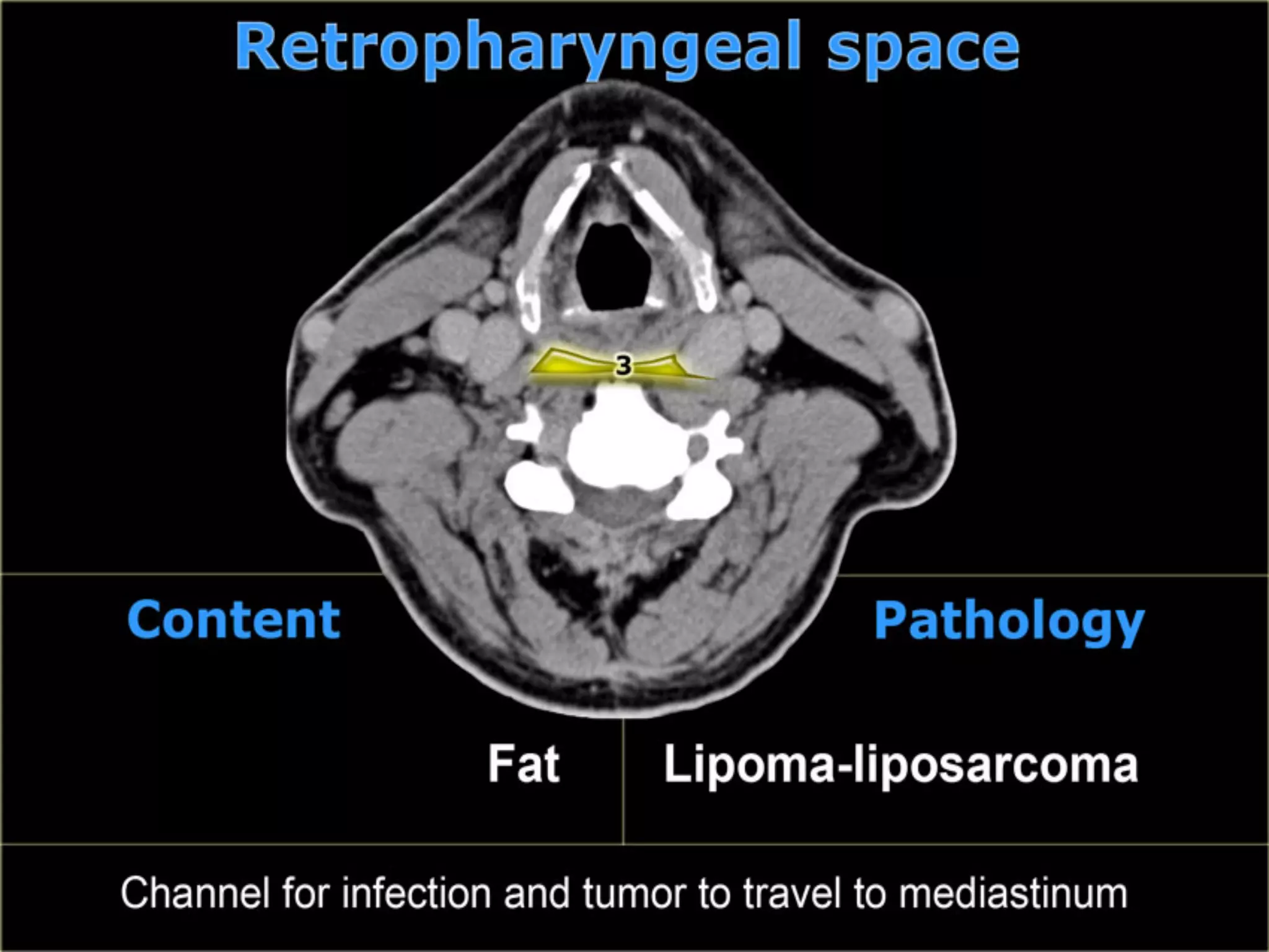 Cross sectional anatomy of the neck | PDF
