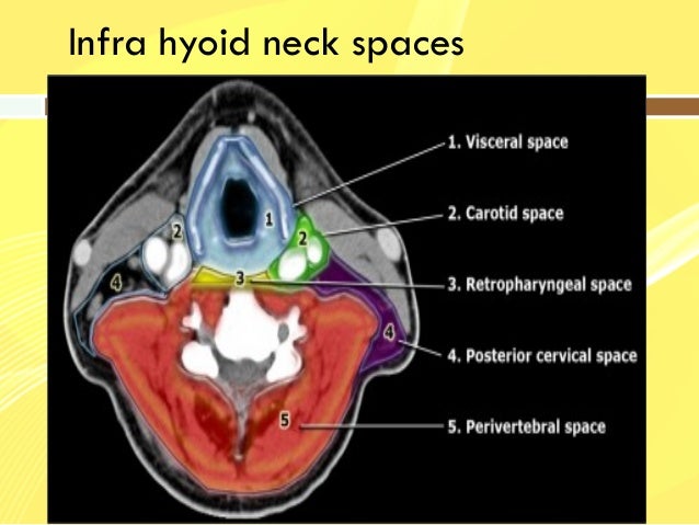 Cross sectional anatomy of the neck