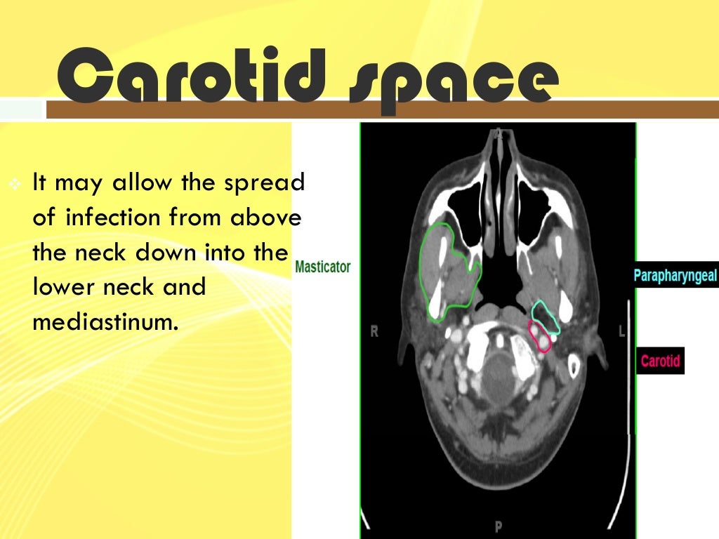 Cross sectional anatomy of the neck