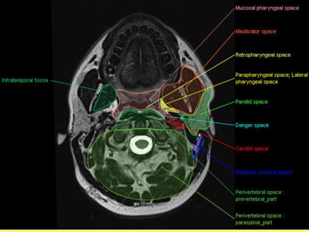 Cross sectional anatomy of the neck