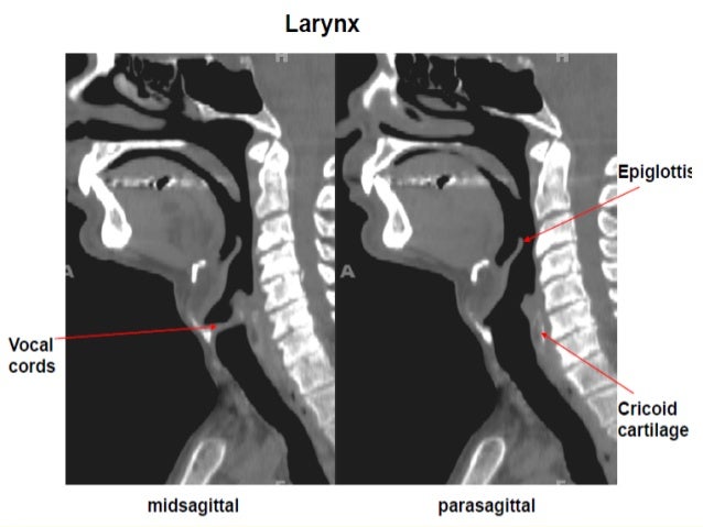 Cross sectional anatomy of the neck