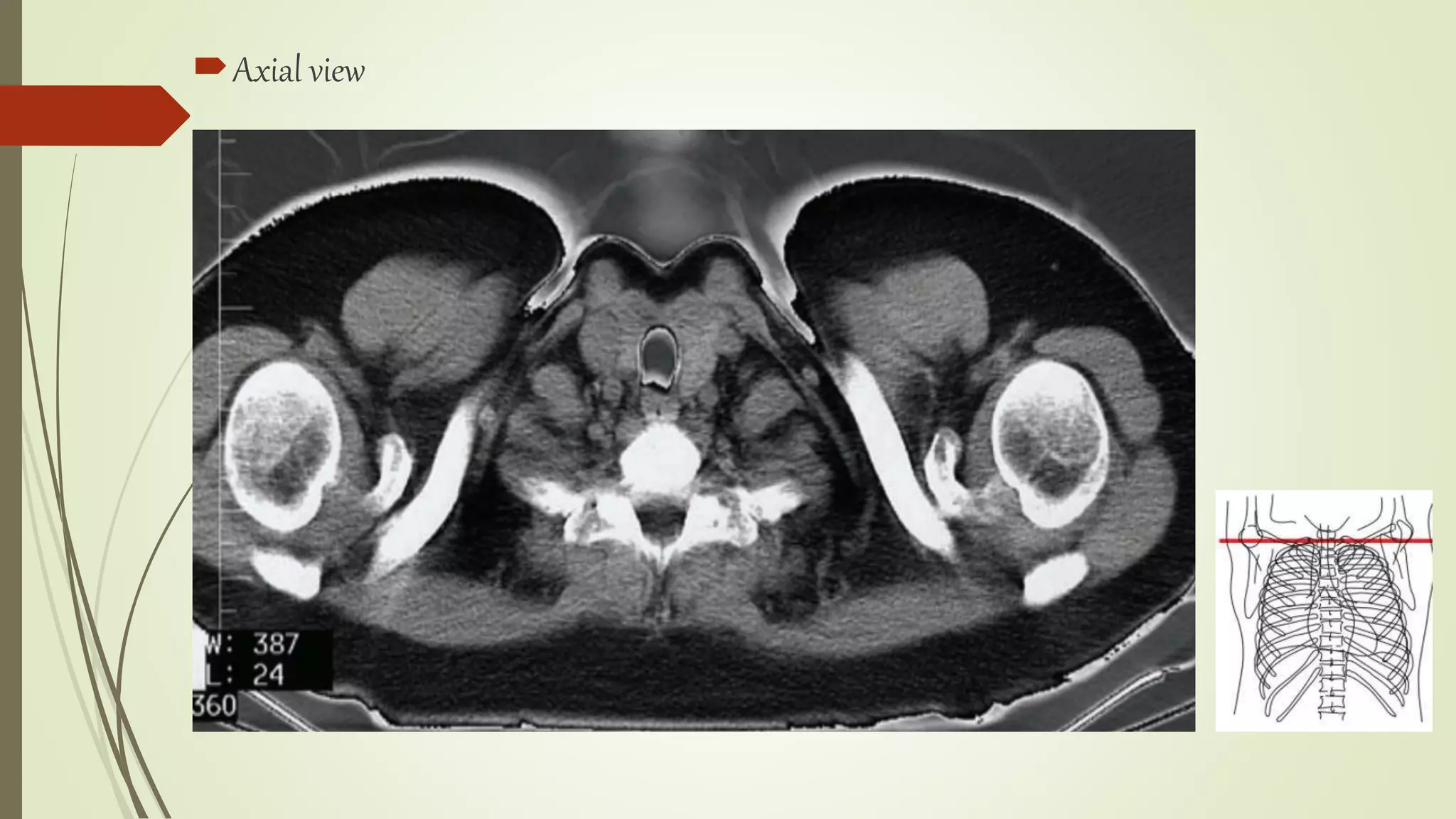 Cross section anatomy of thorax (1) | PPTX