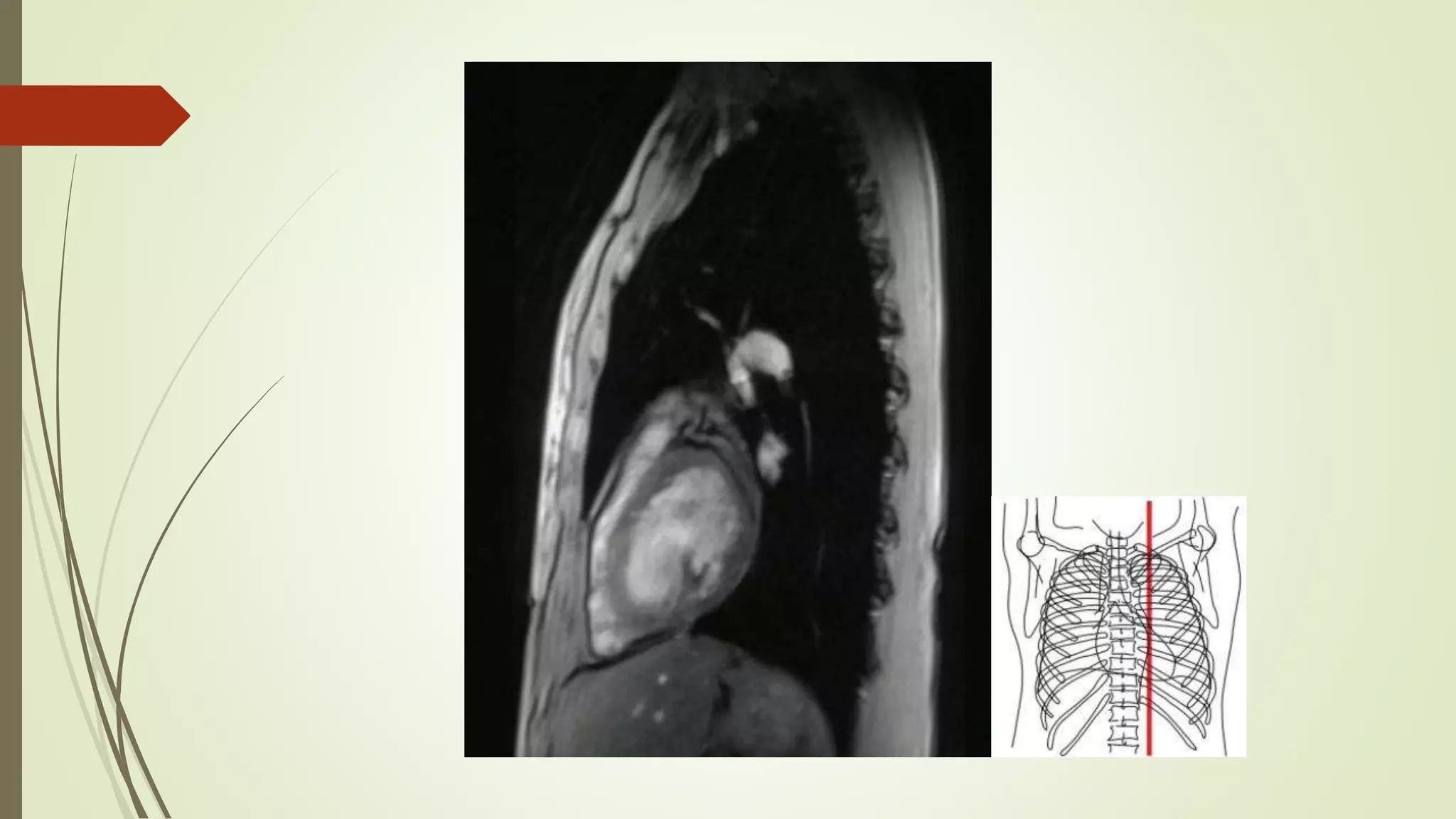 Cross section anatomy of thorax (1) | PPTX