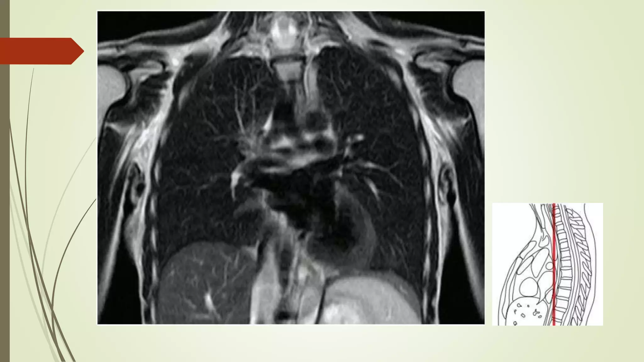 Cross section anatomy of thorax (1) | PPTX