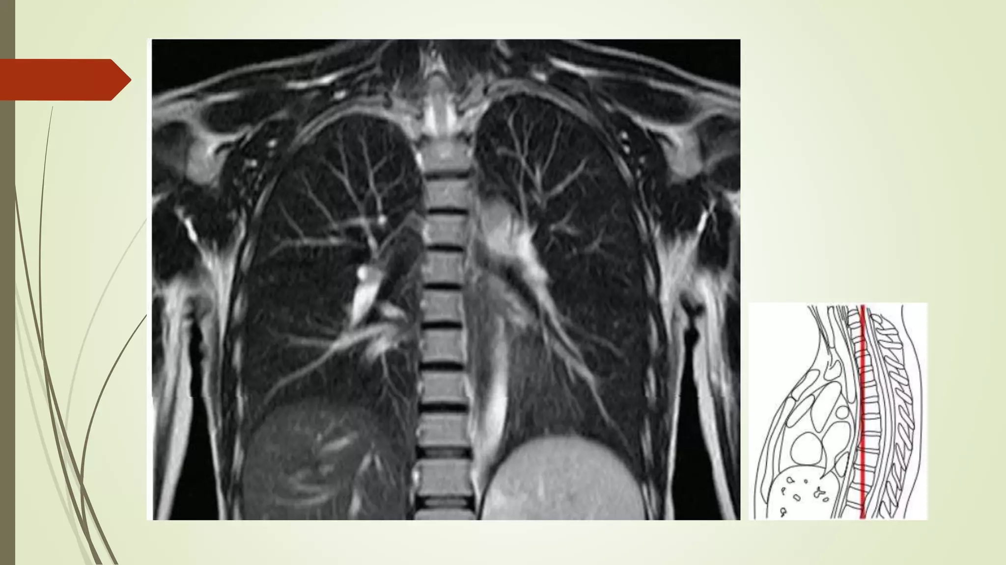 Cross section anatomy of thorax (1) | PPTX