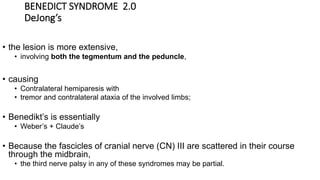 Midbrain anatomy and applied aspects- Dr Sameep Koshti (Consultant ...