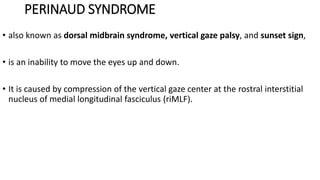 Midbrain anatomy and applied aspects- Dr Sameep Koshti (Consultant ...