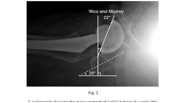 Cross_table_lateral_radiography_for_measurement_of_acetabular (2).pptx