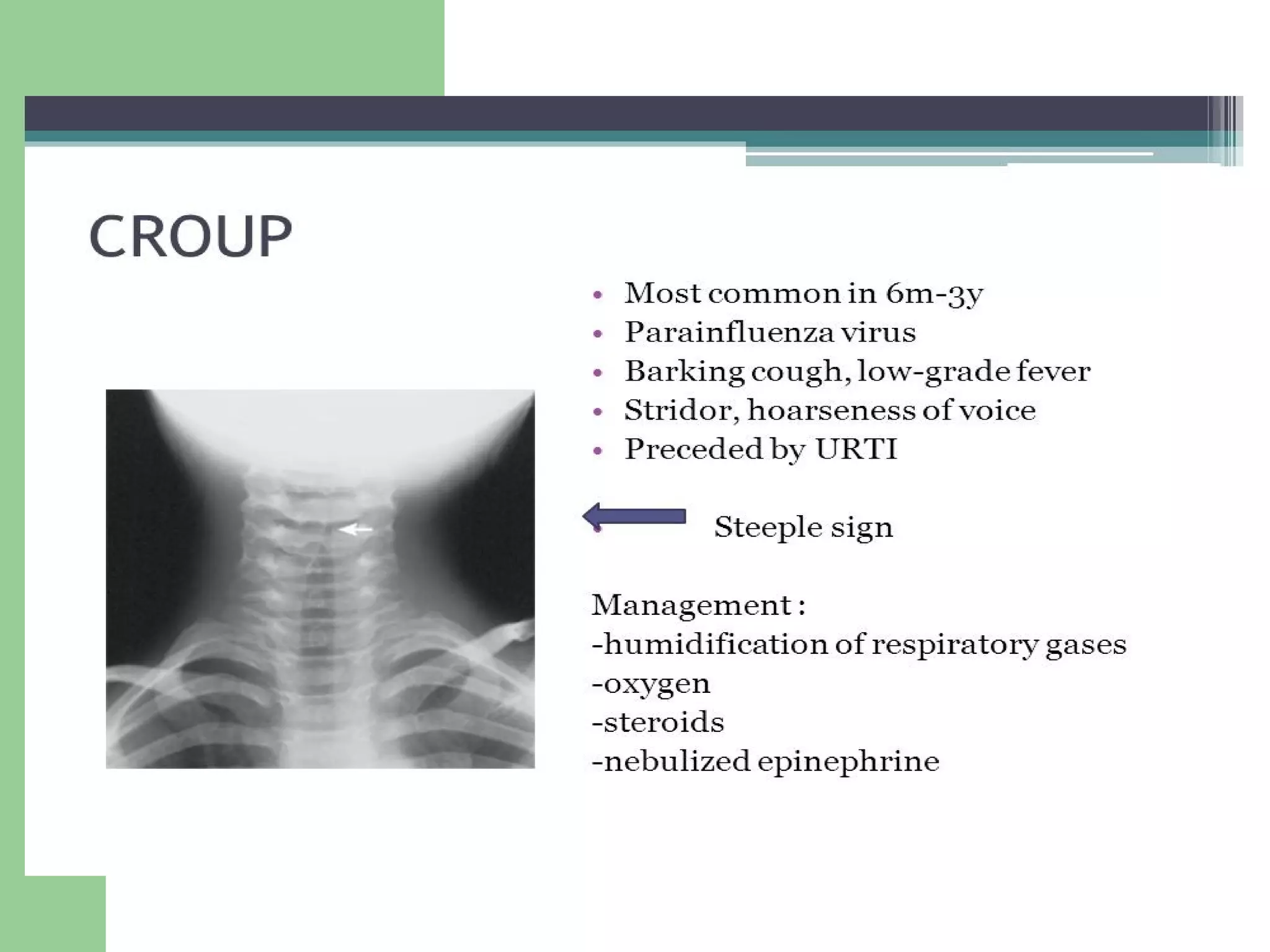 Croup syndrome | PPT