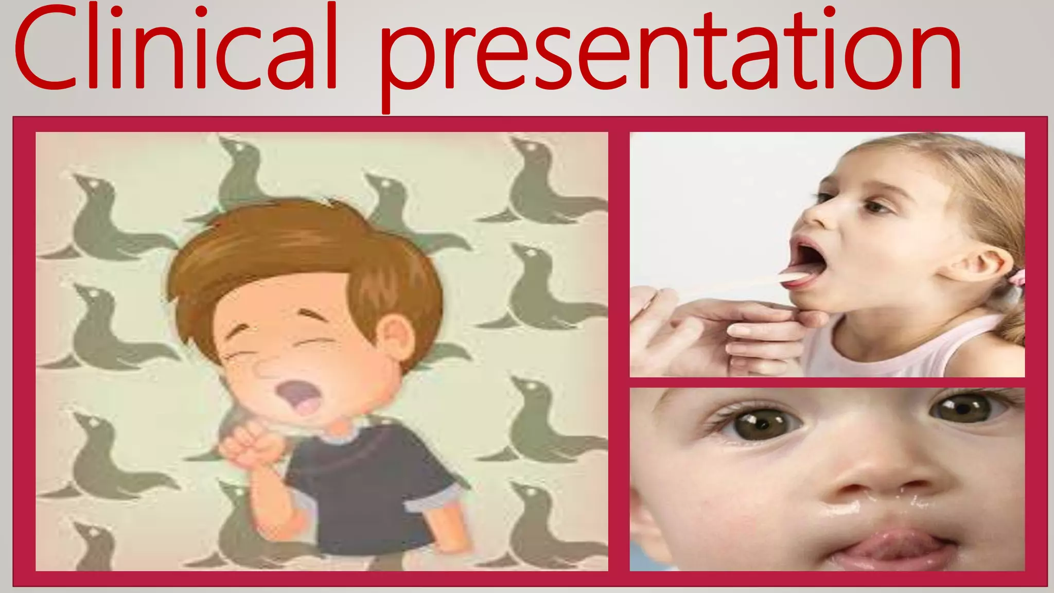 Croup | PPTX