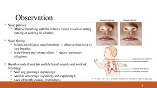 Croup and Bronchiolitis managment, diagnoisis.pptx