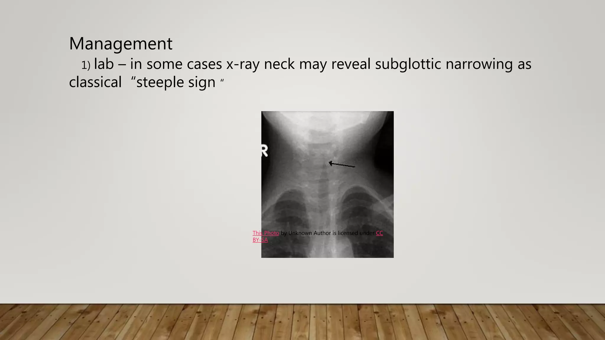 Croup and Epiglottitis by DR.PREMRAJ | PPTX