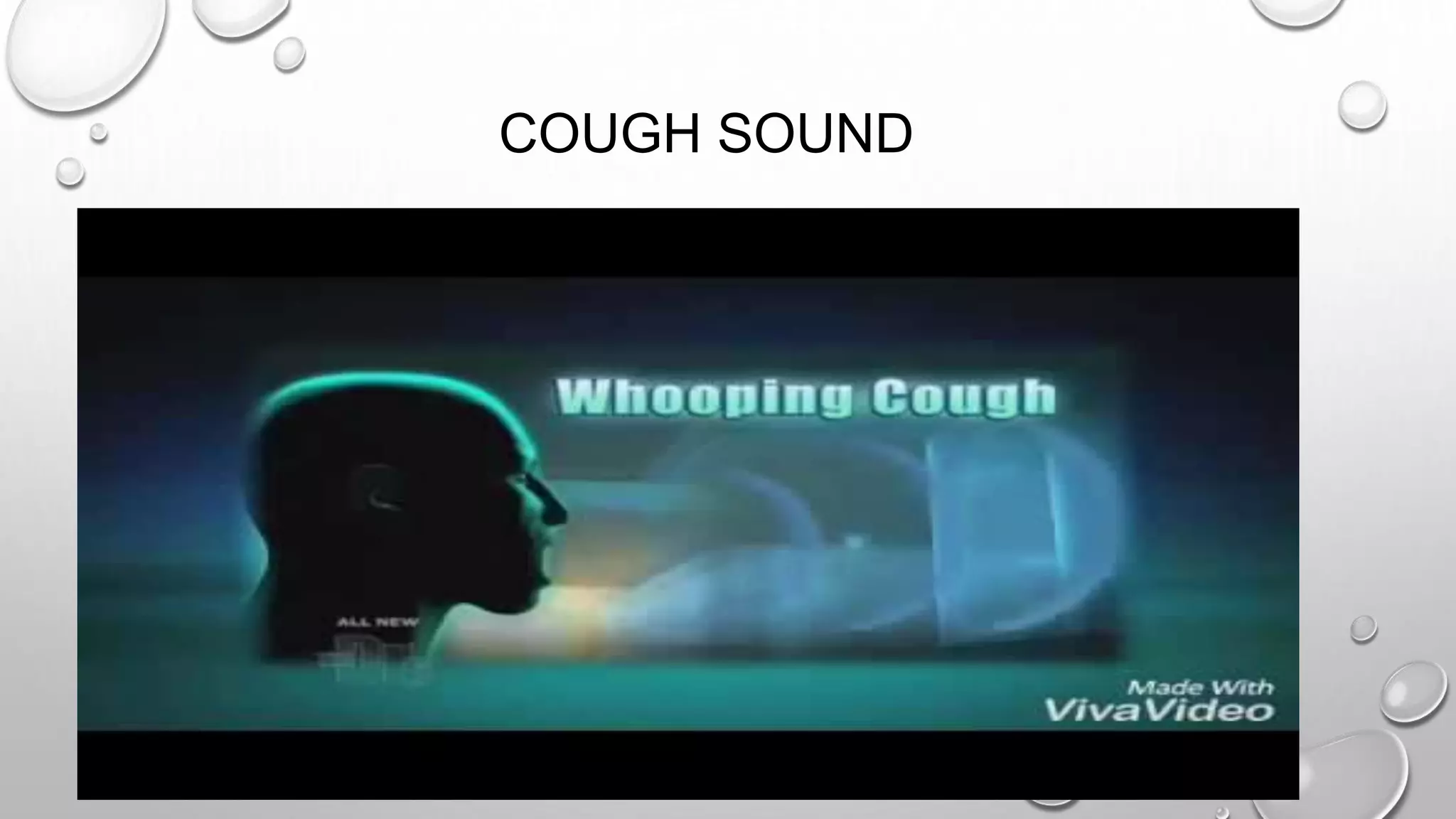Croup disease | PPTX