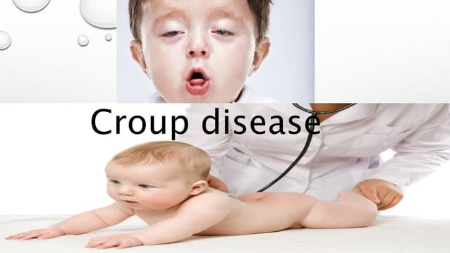 Croup disease | PPTX