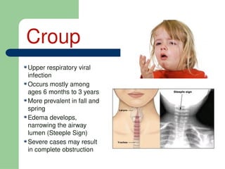 A comprehensive description on Croup & Epiglotitis | PPTX