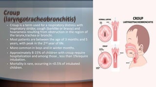 Croup and Epiglottitis.pptx. by dr shahzaib r paracha | PPTX