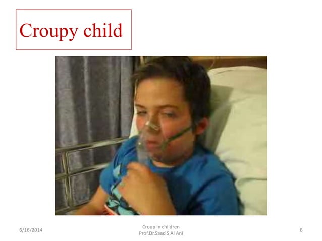 Croup in children | PPTX