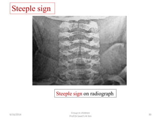 Croup Steeple Sign
