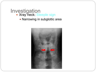 Croup syndrome( diptheria,acute epiglottitis,aryngotracheobronchitis ...