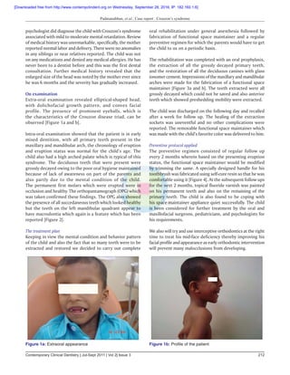 Crouzon’s syndrome: A review of literature and case report.pdf