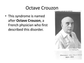 Crouzon syndrome | PPTX