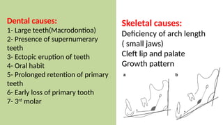 crowding of teeth .pptx management of crowding | PPTX