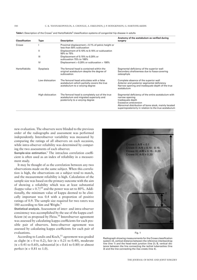 Crowe y hartofilakidis classification ddc in adults | PDF