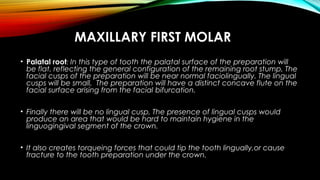 Crown configuration | PPT