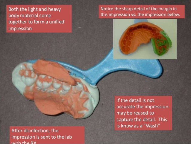 Crown and bridge impression slides