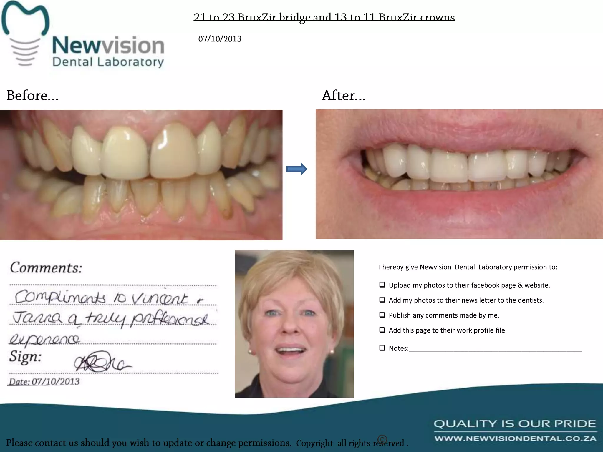 Crown and bridge vmk and bruxir work presentation | PPT