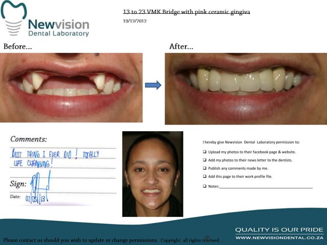 Crown and bridge vmk and bruxir work presentation | PPT