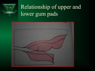 Crown Formation and its stages- Teeth.ppt