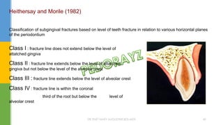 Dental Crown fracture | PPT