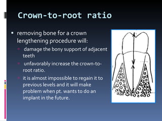 Crown lengthening | PPT