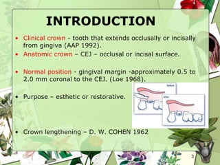 crown lengthening.pptx