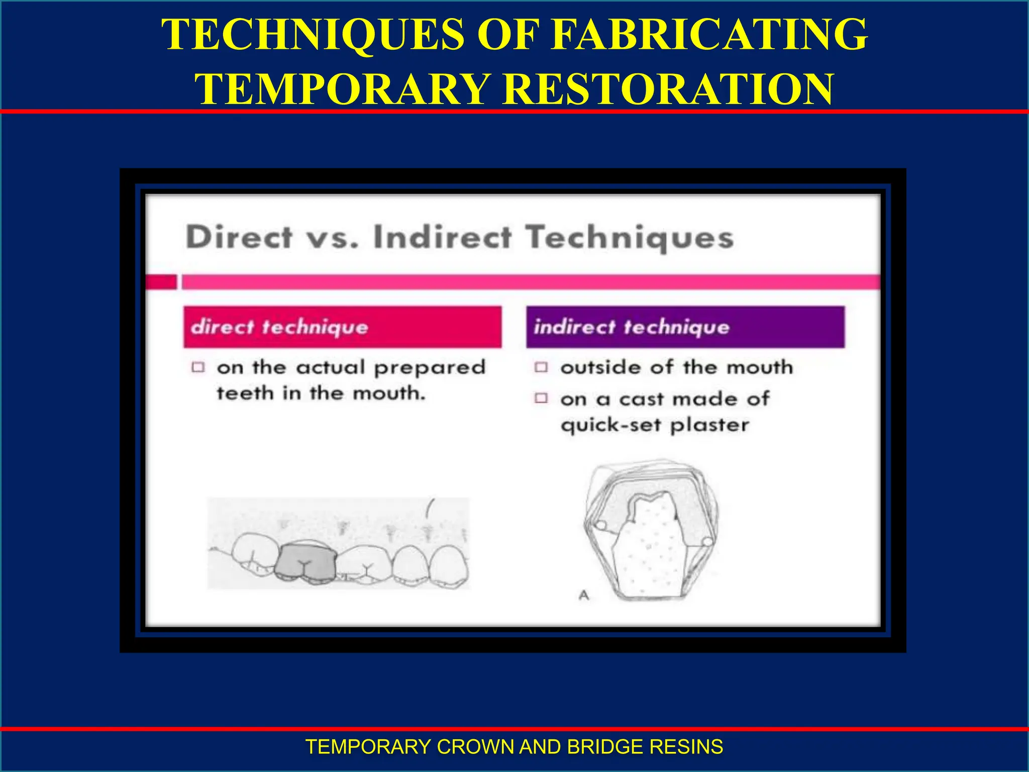 endodontics crown and bridge restoration ppt.pptx