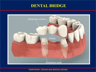 endodontics crown and bridge restoration ppt.pptx