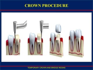 endodontics crown and bridge restoration ppt.pptx