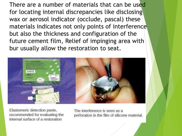 Crown try in and supply | PPTX