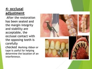 Crown try in and supply | PPTX