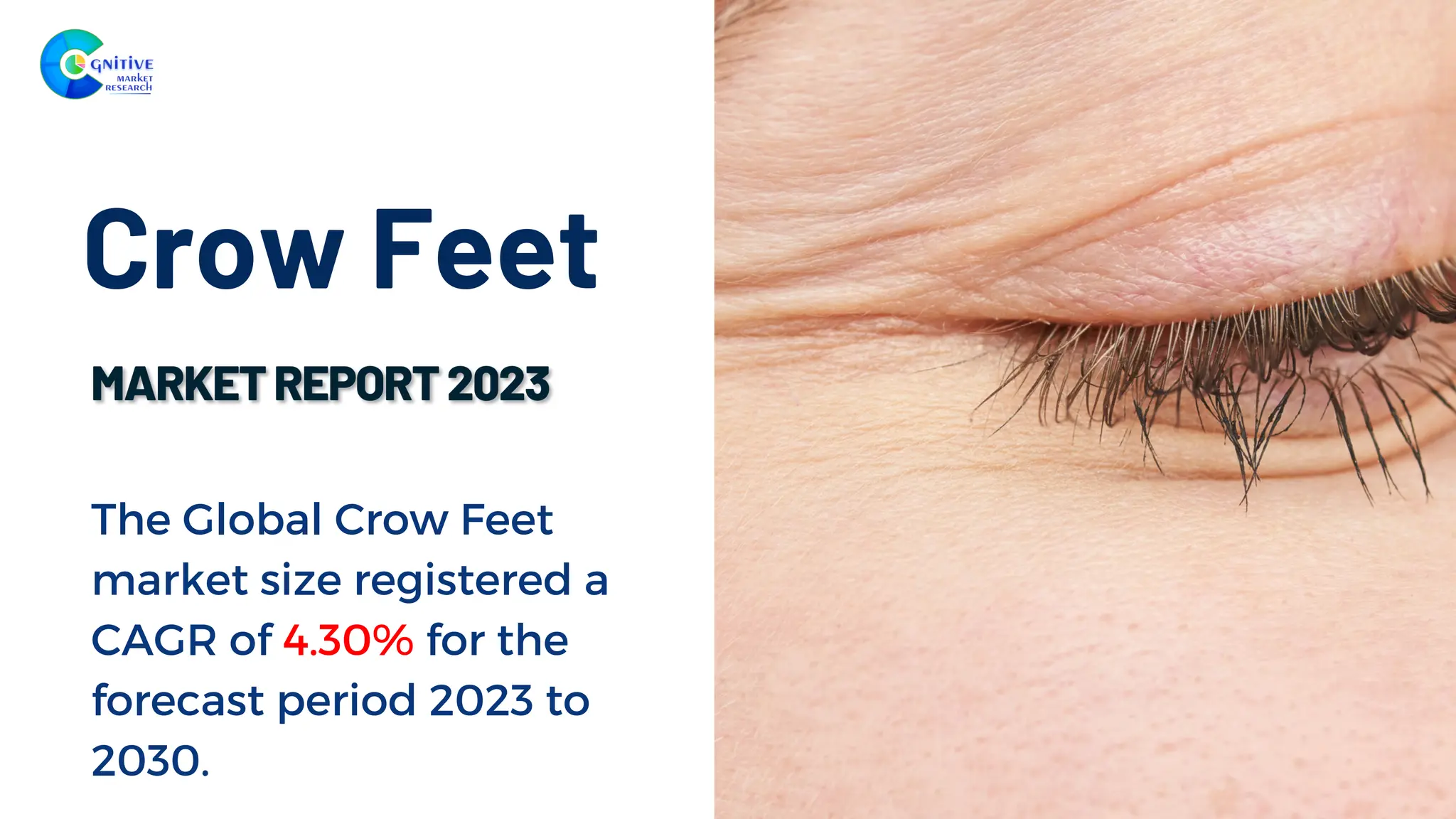 Crow’s Feet Market Report | PPT
