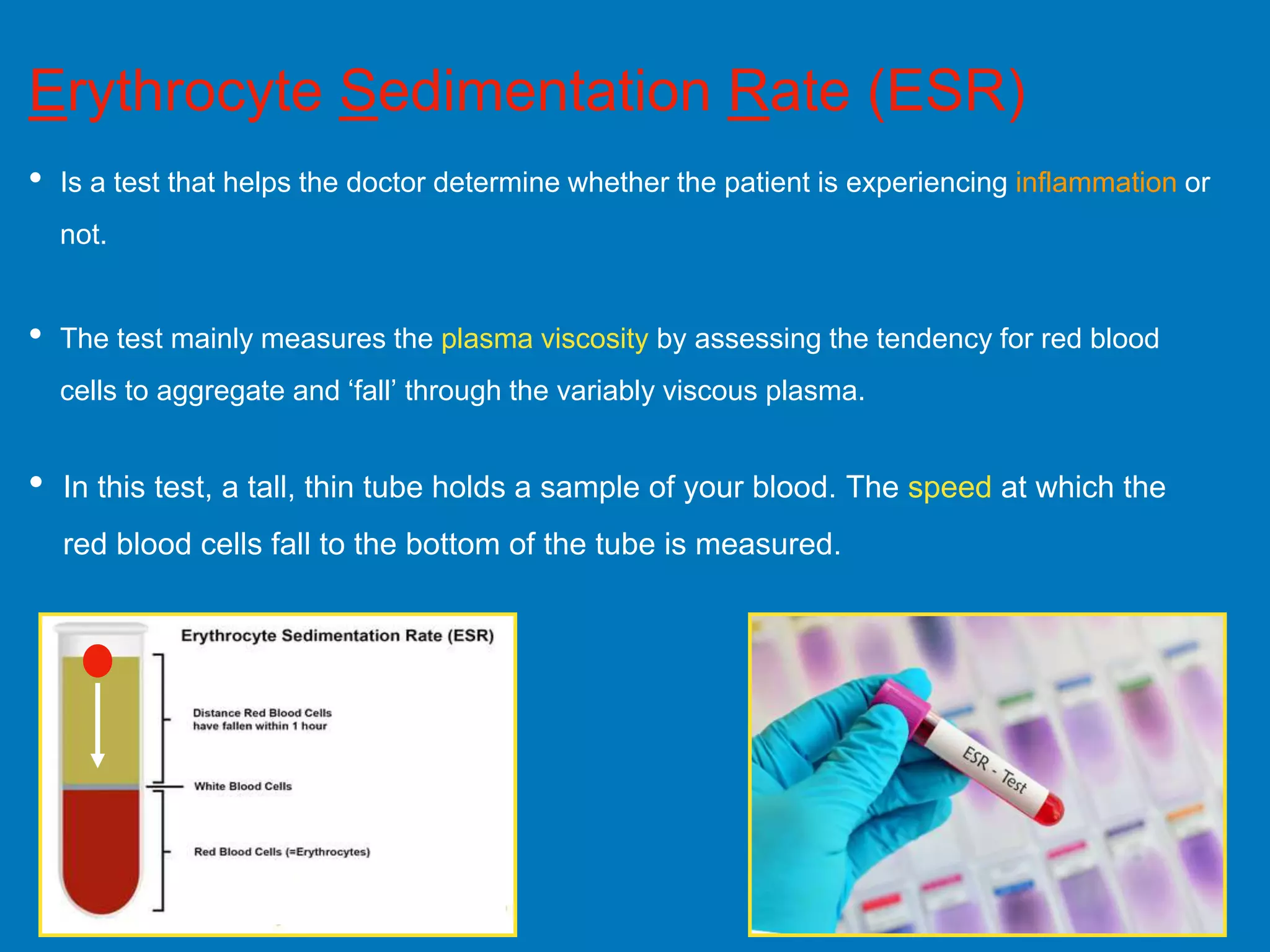 CRP test & ESR test | PPTX