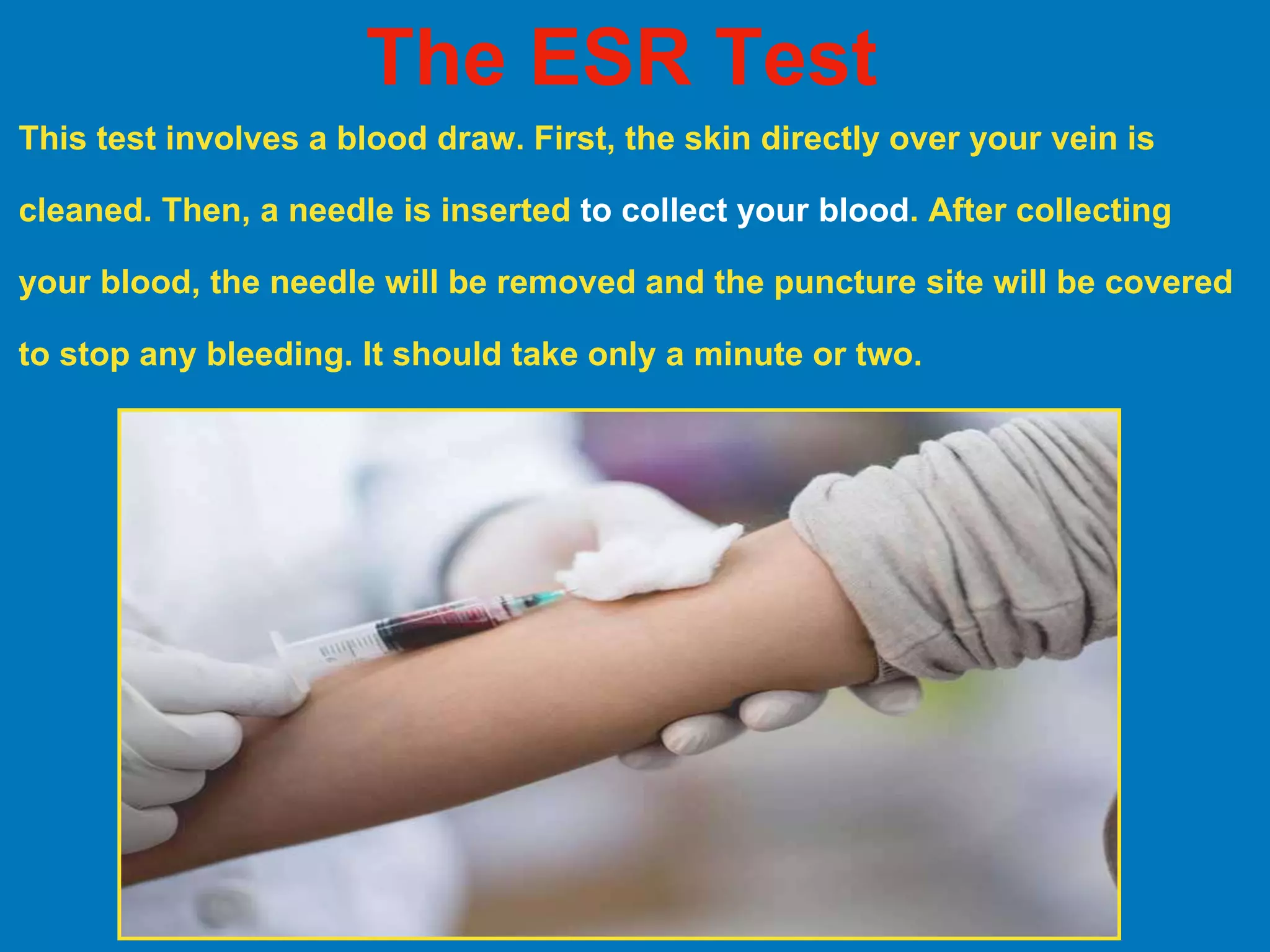 CRP test & ESR test | PPTX