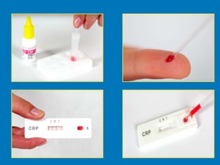 CRP test & ESR test | PPTX
