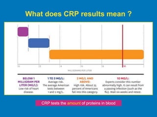 CRP test & ESR test | PPTX