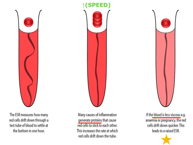 CRP test & ESR test | PPTX | Blood Disorders | Diseases and Conditions